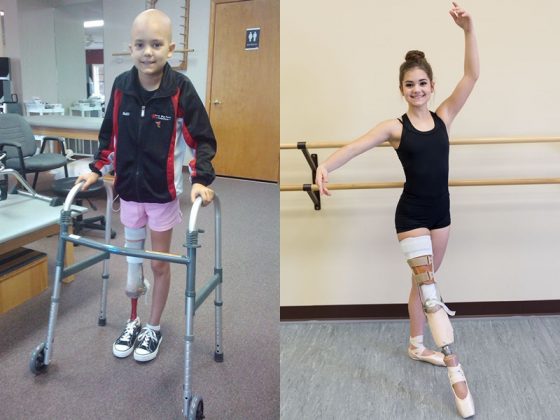 Gabi Shull สาวน้อยยอดนักสู้ แม้ต้องสูญเสียขาเพราะมะเร็งร้าย แต่ฉันก็จะ ...