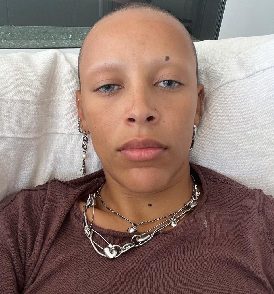 สะดวกแบบนี้! ส่องทรงคิ้วสุดเก๋ของ Doja Cat หลังโกนผมจนโล้น